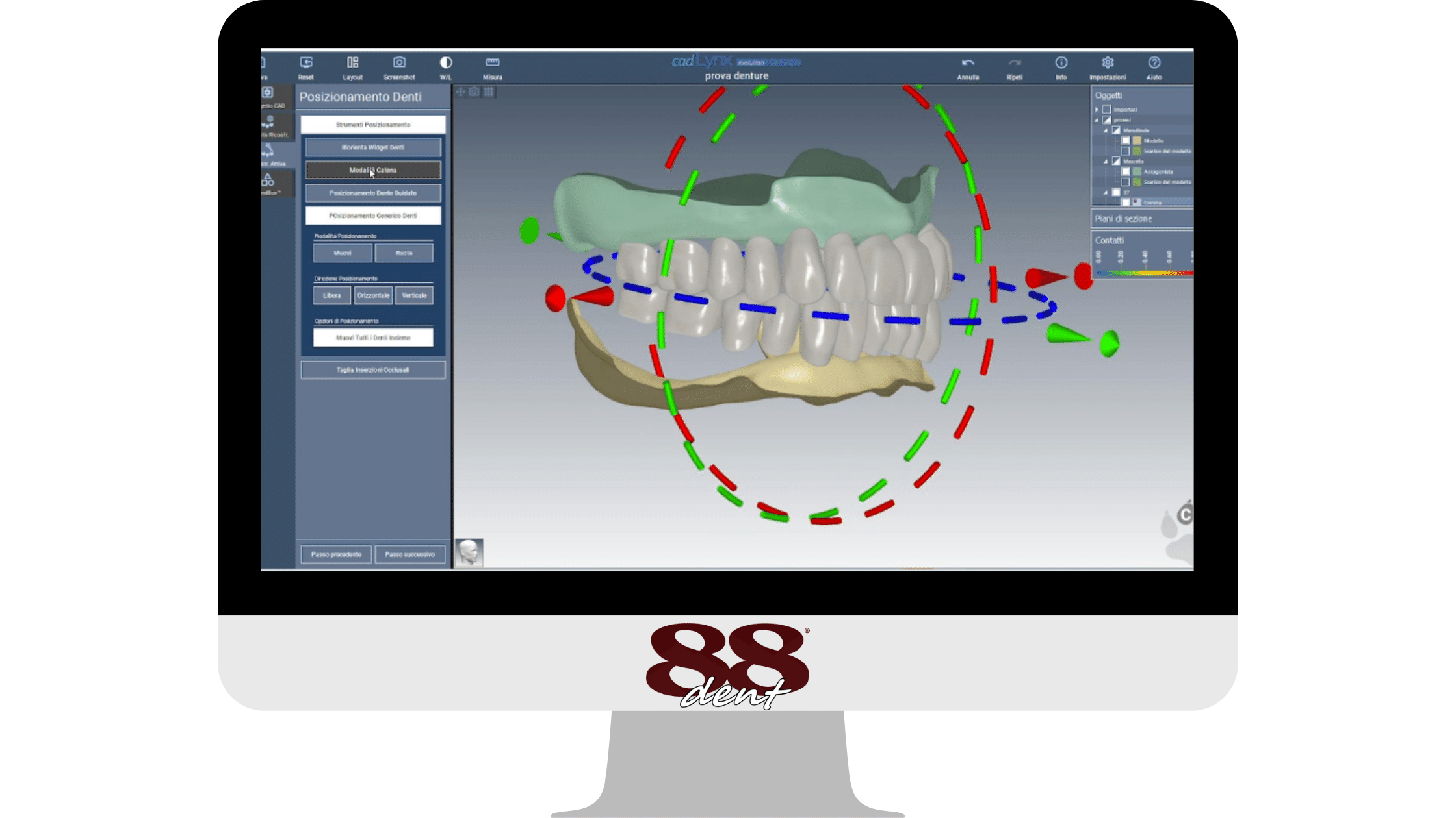 The All4Dentures integrated solution by 88dent